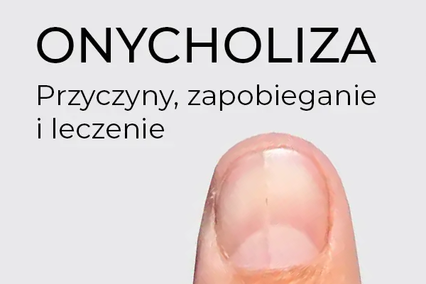 Choroba paznokci: onycholiza – jak leczyć? | Didier Lab